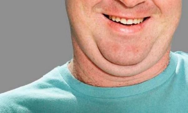 Reducir la papada en hombres